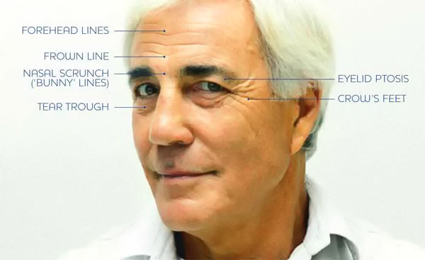 AGEING FACE TREATMENTS at PERFECT FACE | Facial LASER Aesthetics Clinic ...
